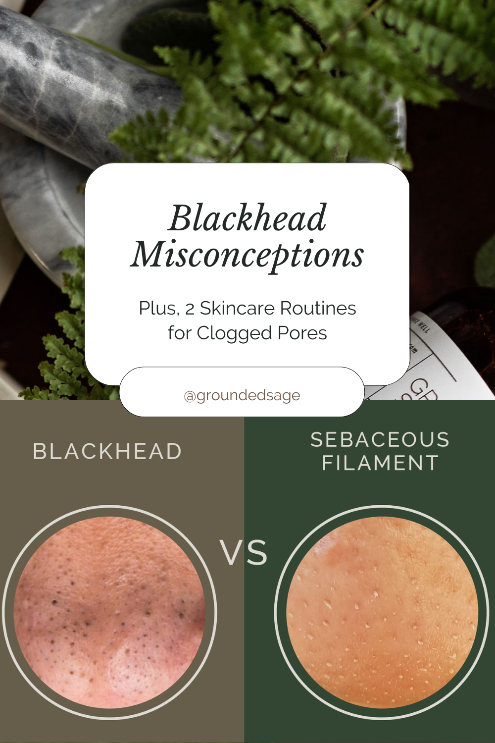 Are they blackheads or Something Else like Sebaceous Filaments? - Grounded Sage